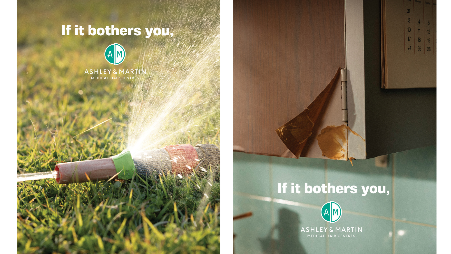 Ashley & Martin Tackles Hair Loss Quick Fixes Via KWP+Partners | LBBOnline