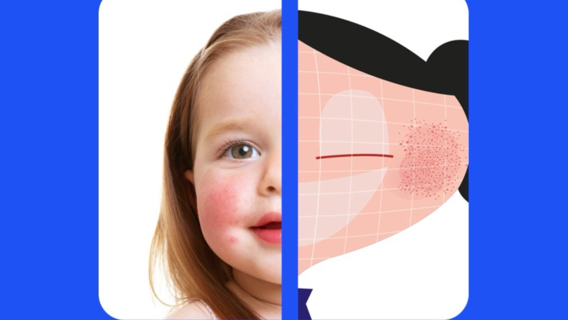 This AI Tool Turns Kids into Cartoon Characters with Skin Conditions ...