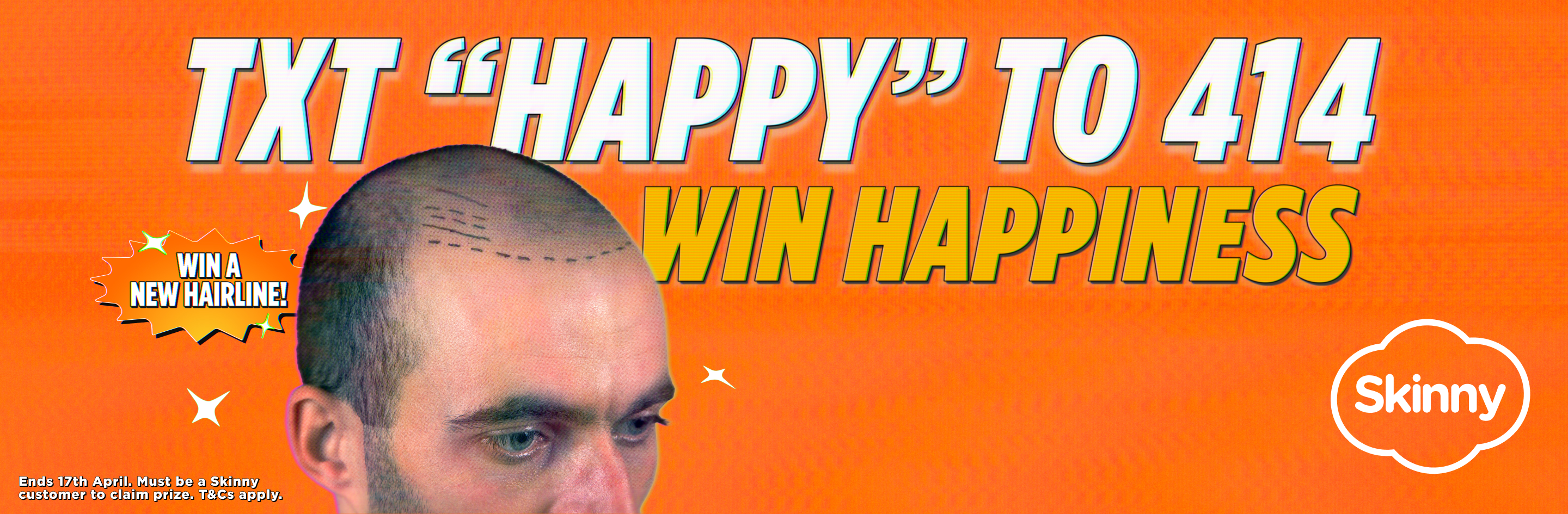 Kiwis Can Turn Private Calls into Skinny Ads to Win New Hairline, Year ...